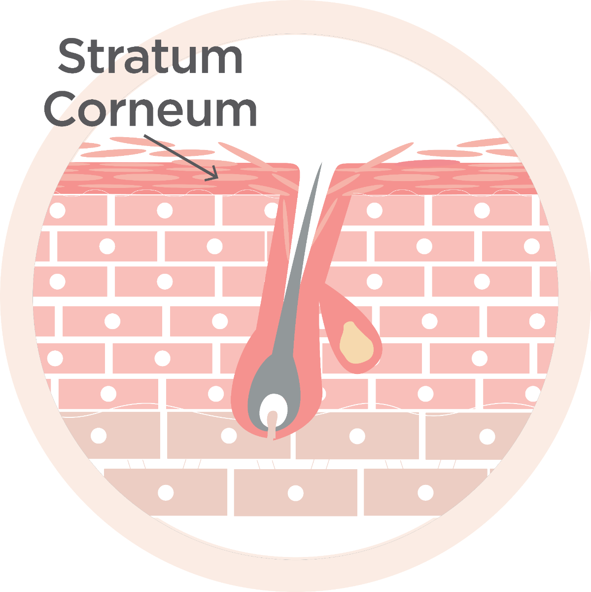 acne tips – Marini SkinSolutions
